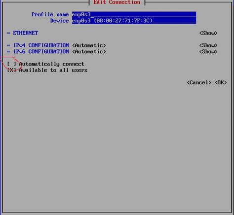 Virtualbox Centos network internet sorun çözümü kr