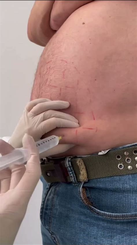 Needle Injection On Fat Mans Belly