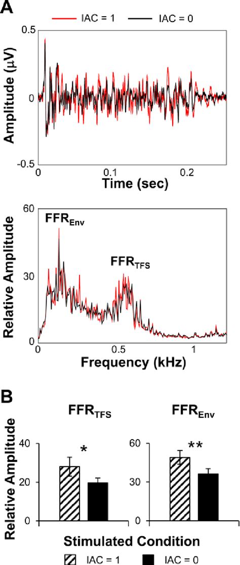 Panel A Waveforms Of The Human Scalp Recorded Ffrs At Either The