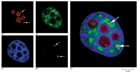 Transkripsi Dna Sintesis And Modifikasi Rna Biokimia Kedokteran Caiherang