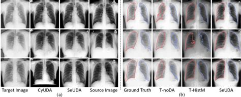Typical Results For The Image Transformation And Lung Segmentation A Download Scientific
