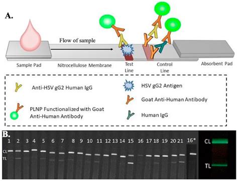Infectious Disease Reports Free Full Text Diagnosis Of Herpes Simplex Virus Laboratory And