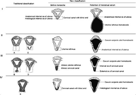 Diagrammatic Anatomical Comparison Between The Traditional Cervix Download Scientific Diagram