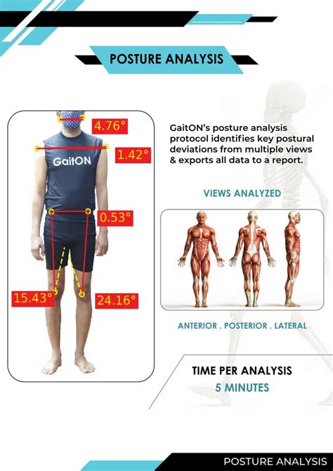 Digital Posture Analysis System Gaiton At Best Price In Delhi Id