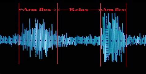 Figure 6 From Prosthetic Arm Control Using Electromyography Emg Signal Semantic Scholar