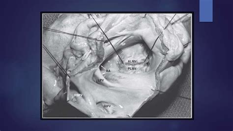 Morphological Anatomy Of Heart Pptx