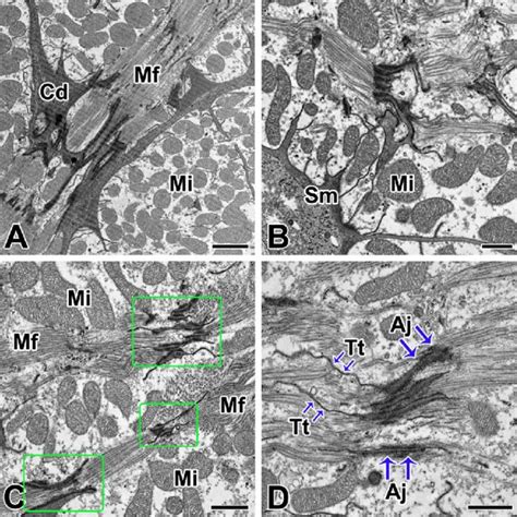 Transmission Electron Micrographs Of The Intercalated Disc In The