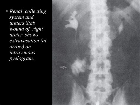 Ivp Rgu And Mcu Pptx Digestive Disorders Diseases And Conditions