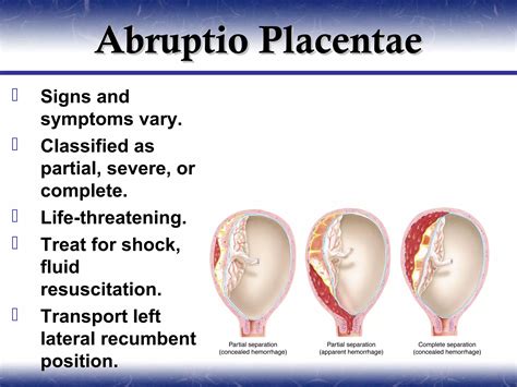 Obstetrics Ppt