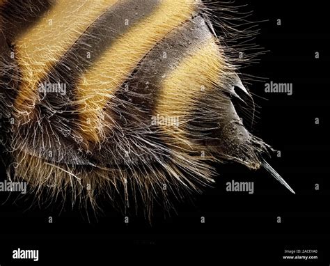 Bee Sting Microscope
