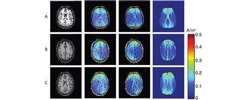 Imaging Brain Activity During Transcranial Electrical Stimulation