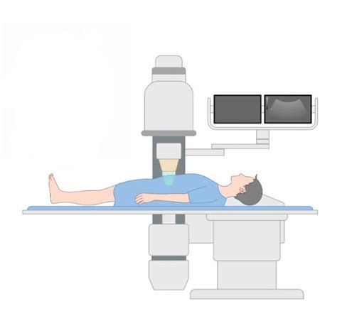 Mathematics Of The Lithotripter Mathematics Of The Lithotripter