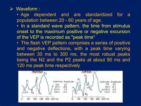 Visual Evoked Potential Ppt