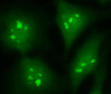 RNA Detection AAT Bioquest