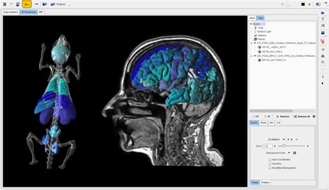 Pmod Quantification Software Bruker