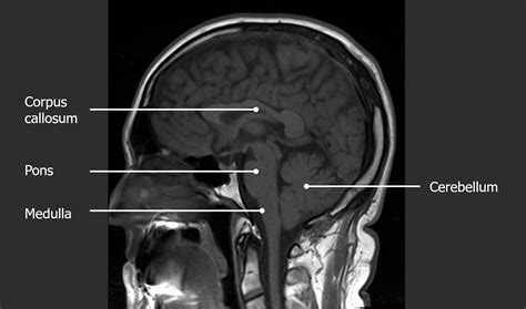 Imaging Of The Head And Brain Concise Medical Knowledge