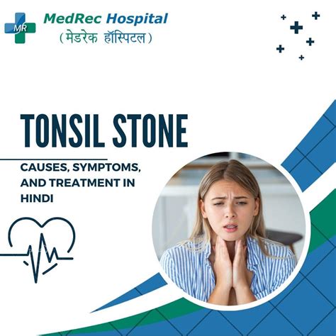 Tonsil Stones Causes Symptoms And Treatment In Hindi Umedrech