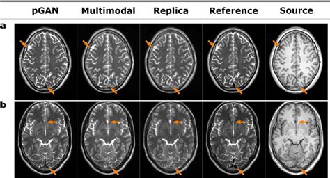 Figure 5 From Image Synthesis In Multi Contrast Mri With Conditional Generative Adversarial