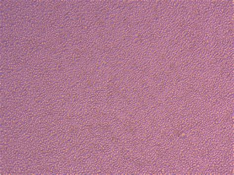 Meeting With Ashish Mehta IPSCs Dr Svenja J Kratz 2021