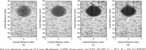 Figure 1 From Eigenspace Based Minimum Variance Beamforming Applied To Medical Ultrasound