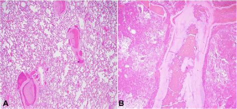 Photomicrographs Of The Lung A Subsegmental Small Pulmonary Arteries