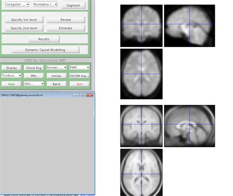 Preprocessing — Weis Menu For Neuroimage 001 Documentation