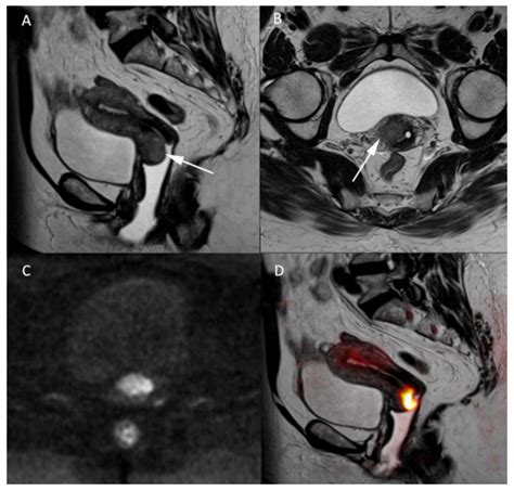Part One Diffusion Weighted MRI In The Genitourinary System Kidney News