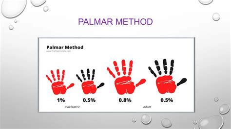 Introduction To Burns And Classification Ppt