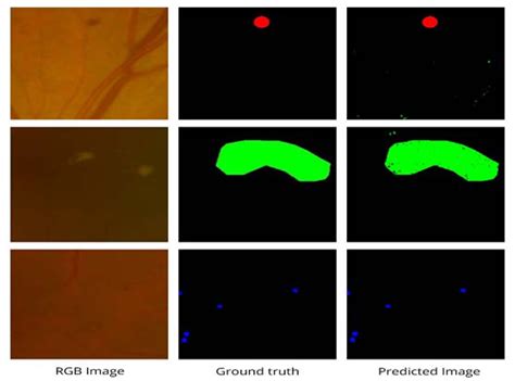 Sample Patches Of A Retinal Multispectral Image With Ground Truth And