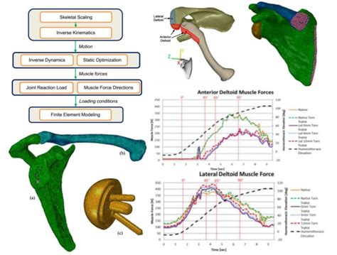 Medicine In Novel Technology And Devices On Linkedin The Evaluation Of Reverse Shoulder