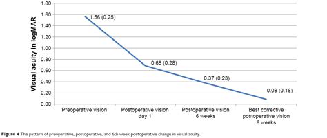 27 Gauge Needle Assisted Externalization And Haptic Securing Technique Opth