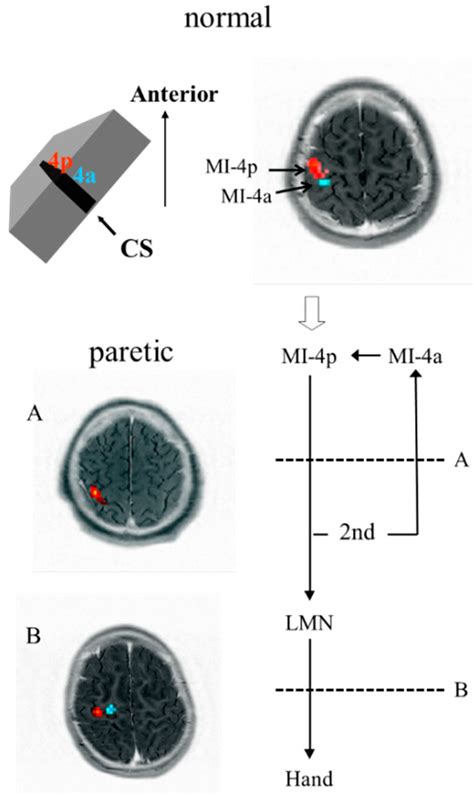 Entropy Special Issue Entropy In Human Brain Networks