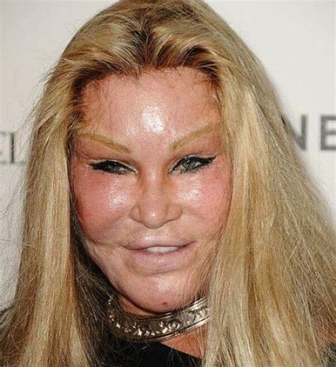 Weird Looking Celebrities After Plastic Surgery