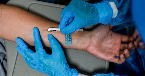 Sex Between Men Not Skin Contact Is Fueling Monkeypox New Research Suggests