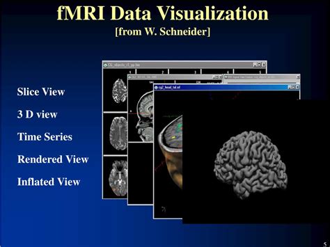 Ppt Data Analysis For Fmri Powerpoint Presentation Free Download