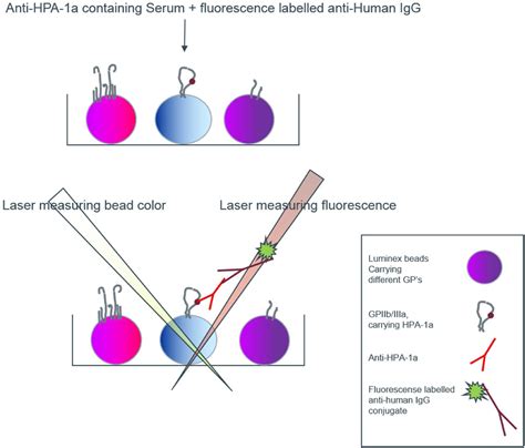 Progress And Development Of Platelet Antibody Detection Transfusion And Apheresis Science