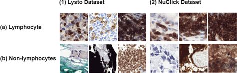 Examples From Ihc Stained Datasets 1 Lysto And 2 Nuclick Panel