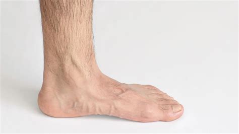Vello En Los Pies Por Qué La Falta De Pelos Podría Ser Una Señal De