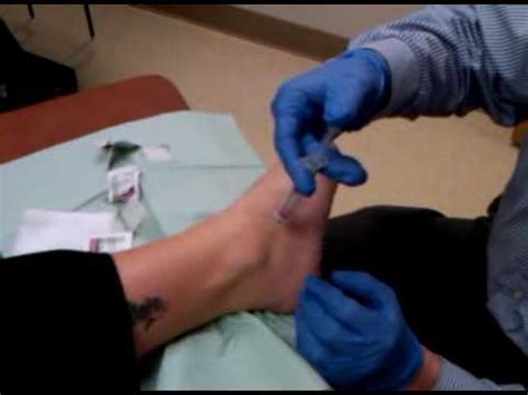 Sinus Tarsi Injection Tuspm Youtube