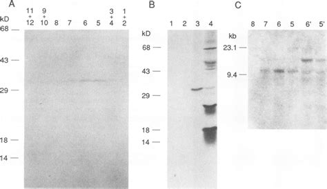 Sucrose Gradient Sedimentation Of Preintegration Complexes S400 Column Download Scientific