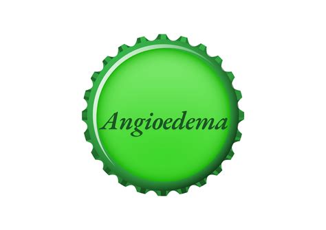 Angioedema Choose Health