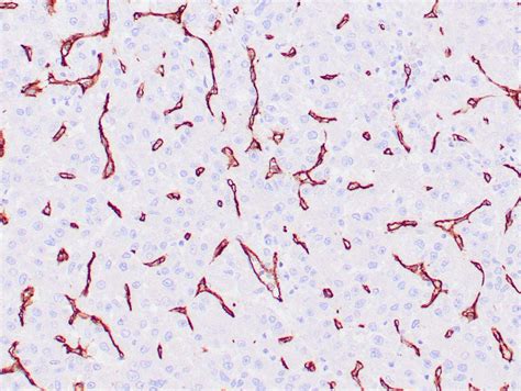Cd34 Antibody Recombinant Ivd Antibody For Ihc Zeta Corporation