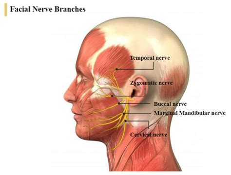 Branches Of The Facial Nerve Download Scientific Diagram