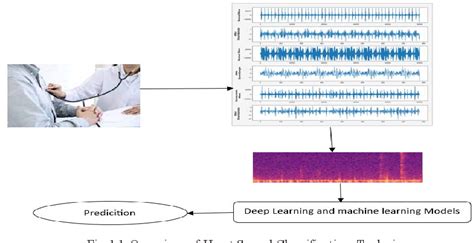 Figure 1 1 From Improved Heart Sound Classification Using Lstm Based Deep Learning Technique