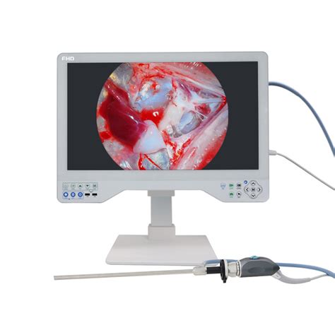 Medical Instruments Tuyou Laparoscopic Camera Surgical Equipments