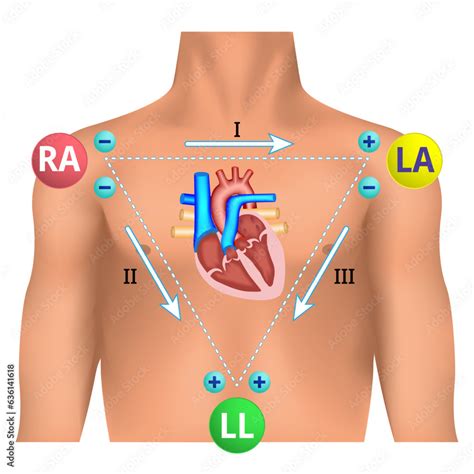 Standard Limb Leads Ecg Einthoven Triangle Electrocardiogram Lead