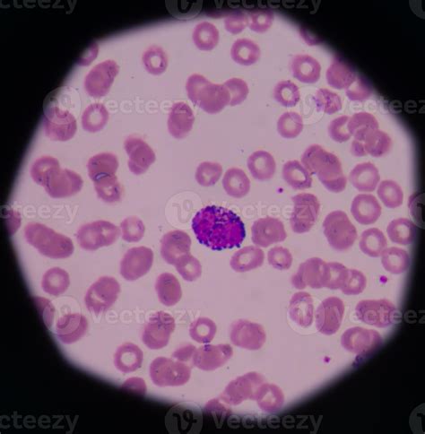 Basophil Under Microscope