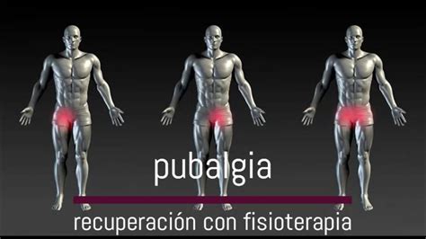 Pubalgia Lesión De Deportistas Resobert Medicina And Radiología