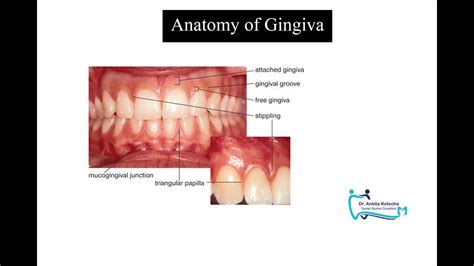Festooned Gingival Contour At Andrea Newton Blog
