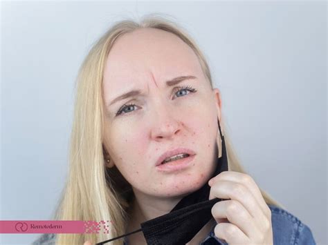 Folliculitis Symptoms Causes Treatment Remotederm